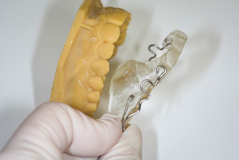 Les contentions - Sandrine Gros - Chirurgien dentiste, spécialiste en ...